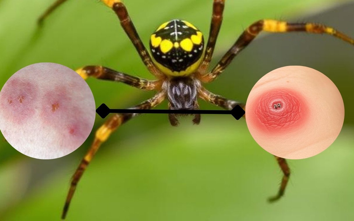 Banana Spider Bites: Symptoms & Risks Explained
