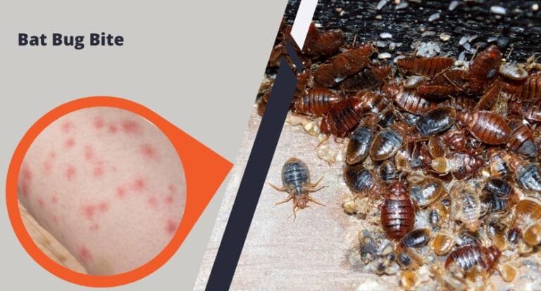 10 types of bed bug bites: Identification chart with pictures