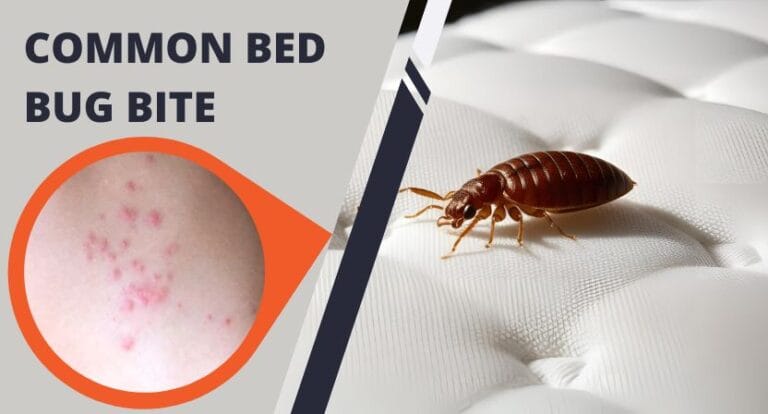 10 types of bed bug bites: Identification chart with pictures