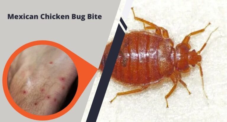 10 types of bed bug bites: Identification chart with pictures