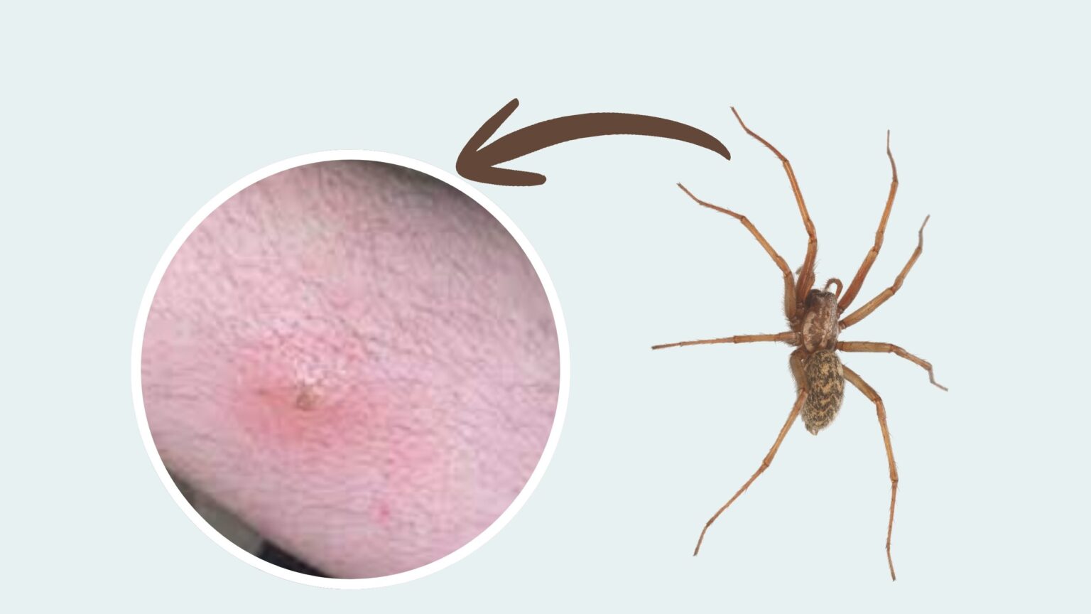 Brown Recluse Spider Bite: Identification with Pictures