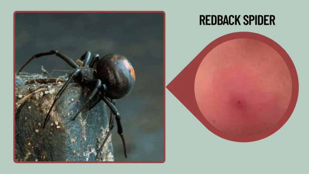 7 Most Deadliest Spiders on Earth: Bite, Symptoms & More