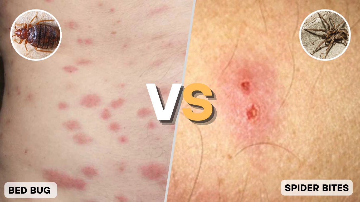 Bed Bug vs Spider Bites: Identification with Images