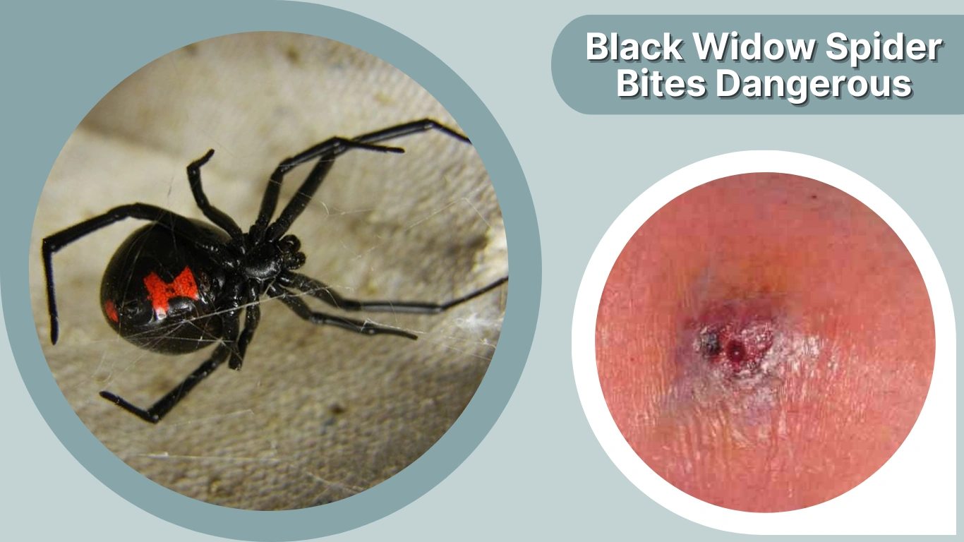 Are Black Widow Spider Bites Dangerous? Everything You Need to Know