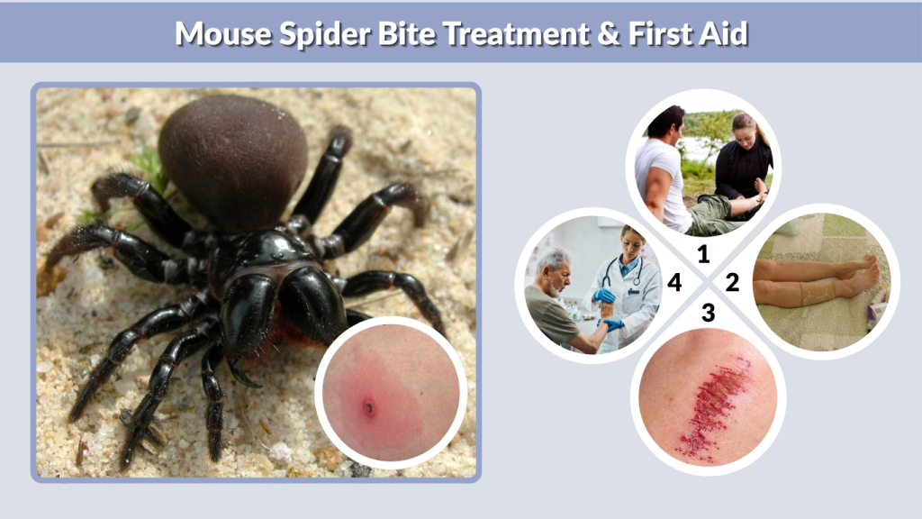 Mouse Spider Bite: Symptoms, Identification & Treatment