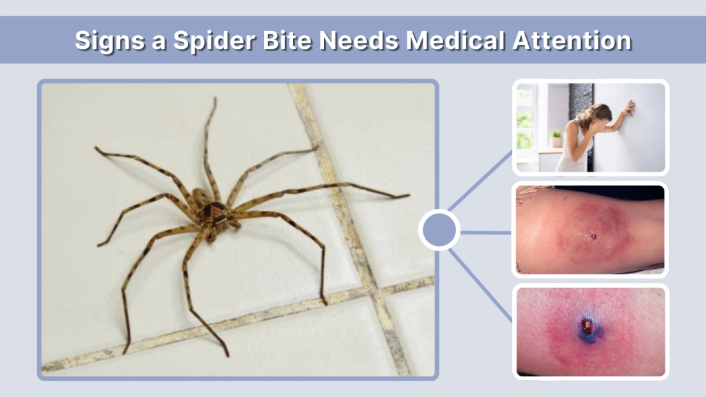 10 Signs a Spider Bite Needs Medical Attention