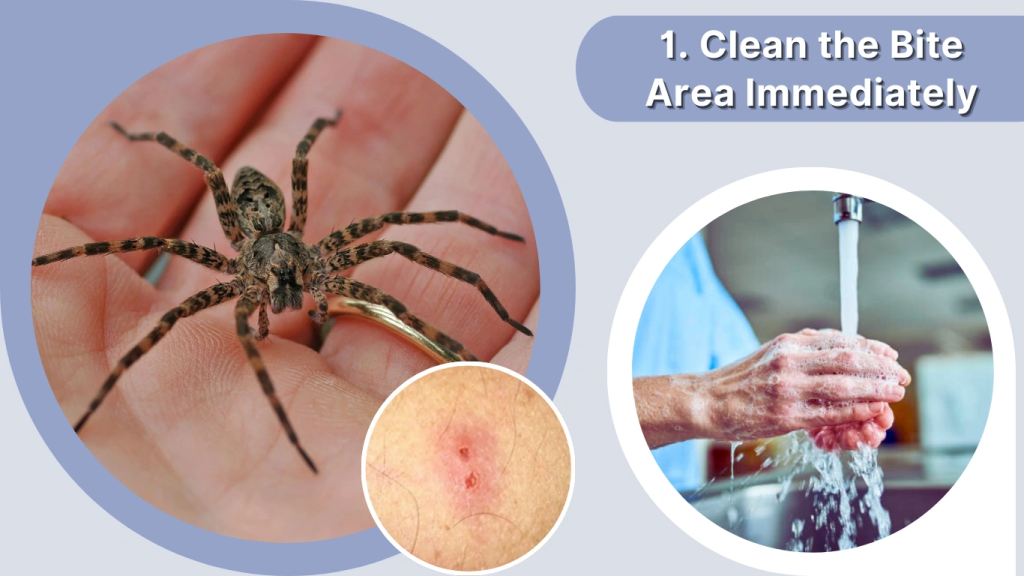 Spider Bite Treatment: 7 Best Ways to Heal Safely